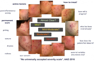 Encoding clinicians decision process in grading acne- severity scale ...